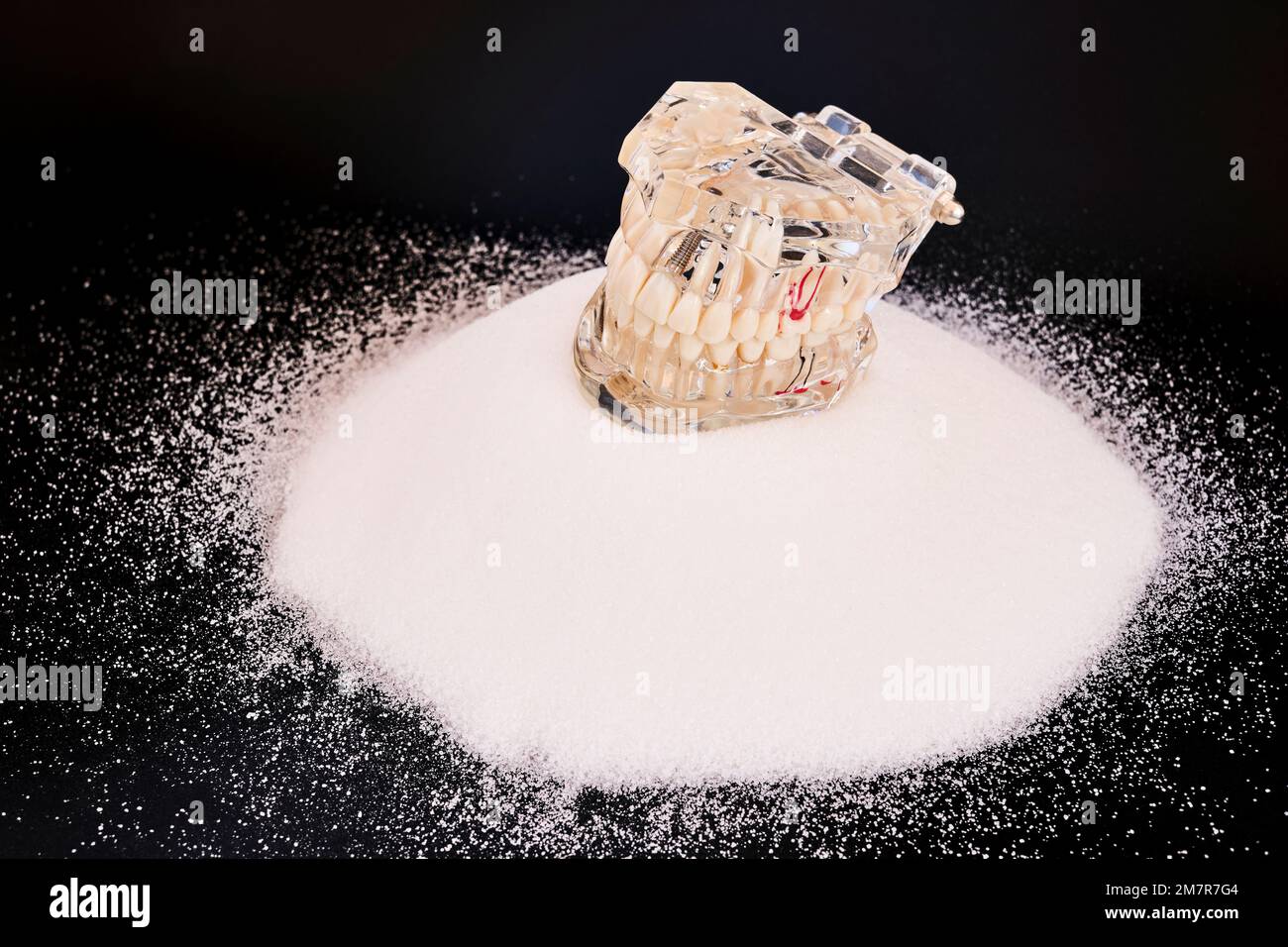 Tooth decay causes hi-res stock photography and images - Alamy