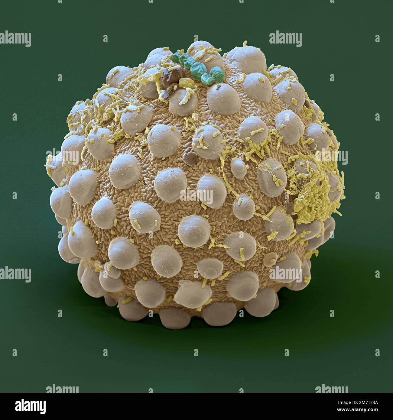 Tardigrade egg, SEM Stock Photo - Alamy
