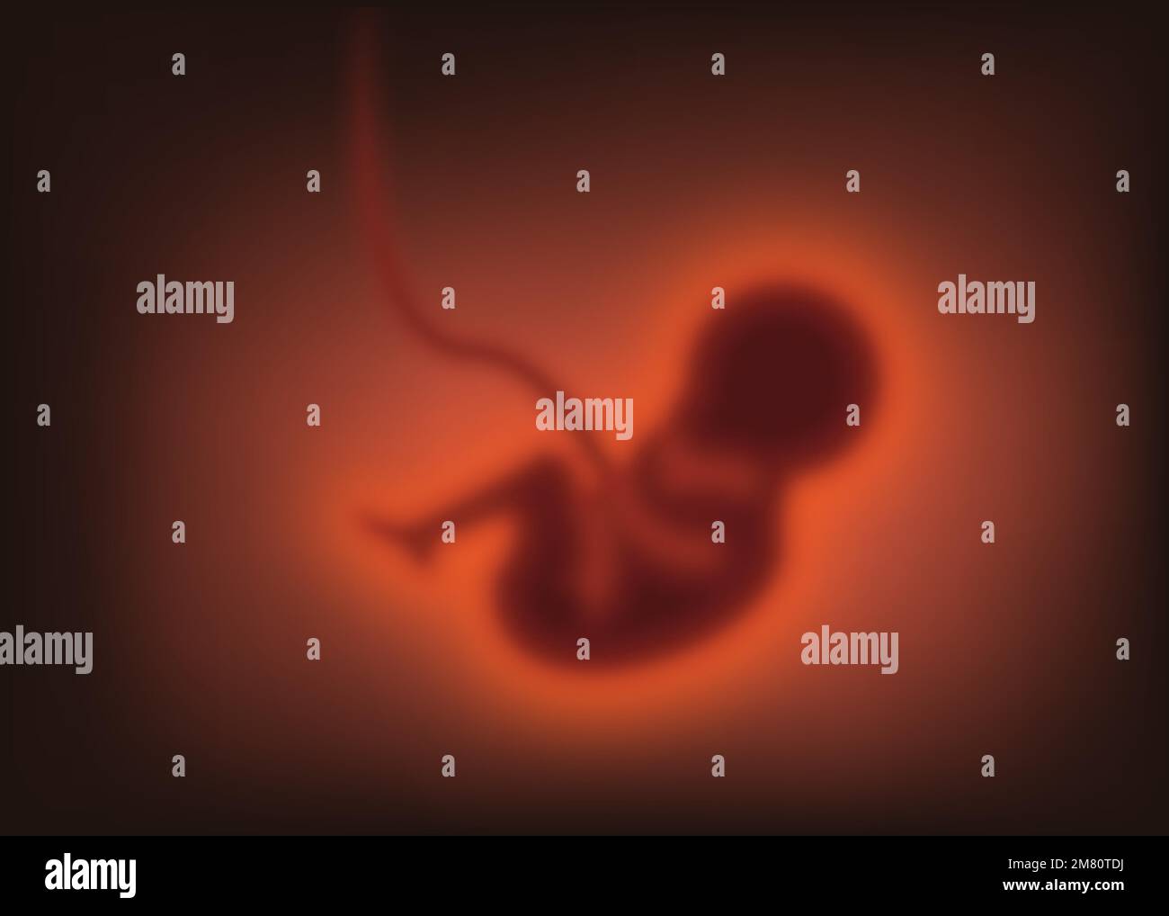 Pregnancy concept. Blurred Child in the womb, embryo. Vector ...