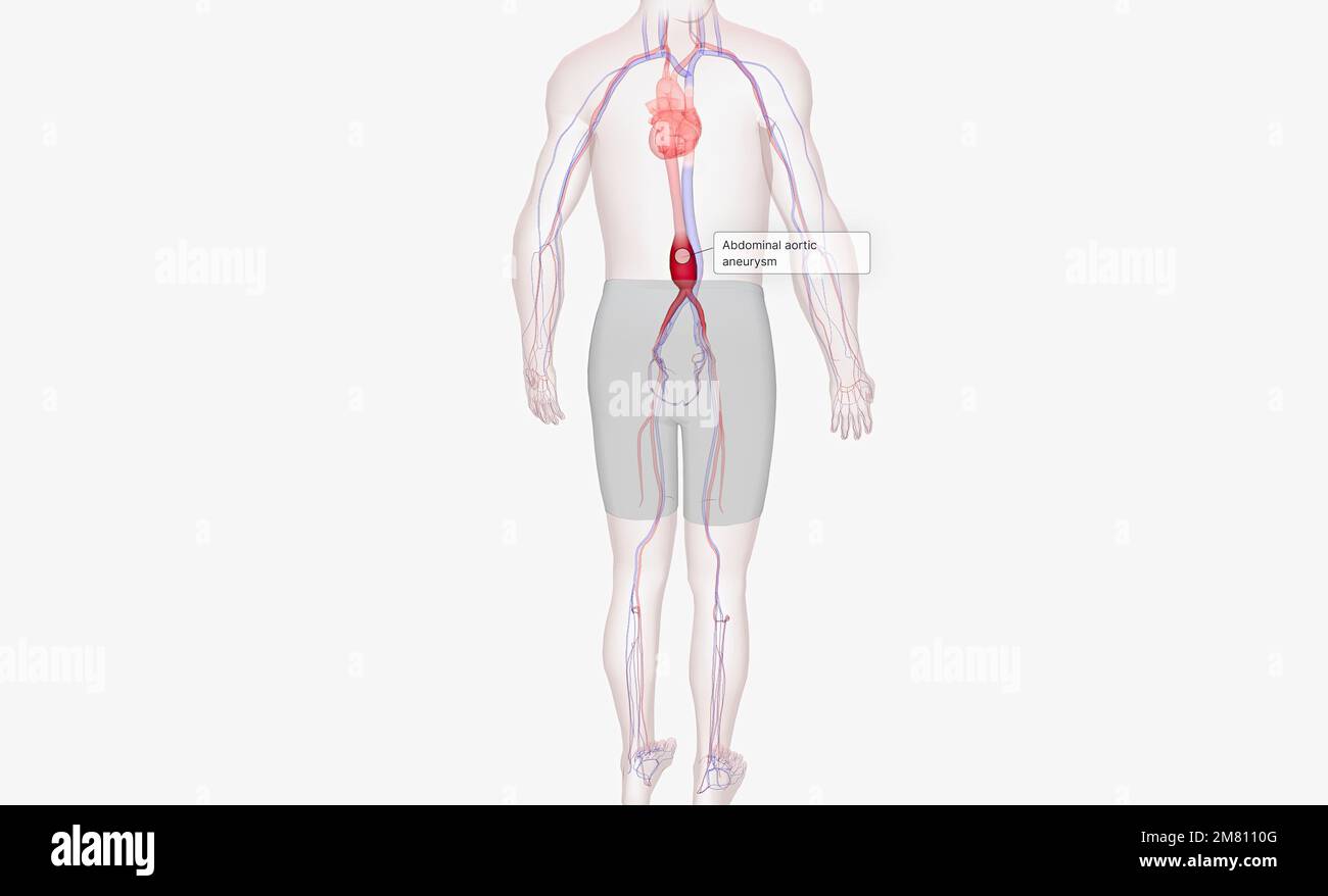 Auscultation artery hi-res stock photography and images - Alamy