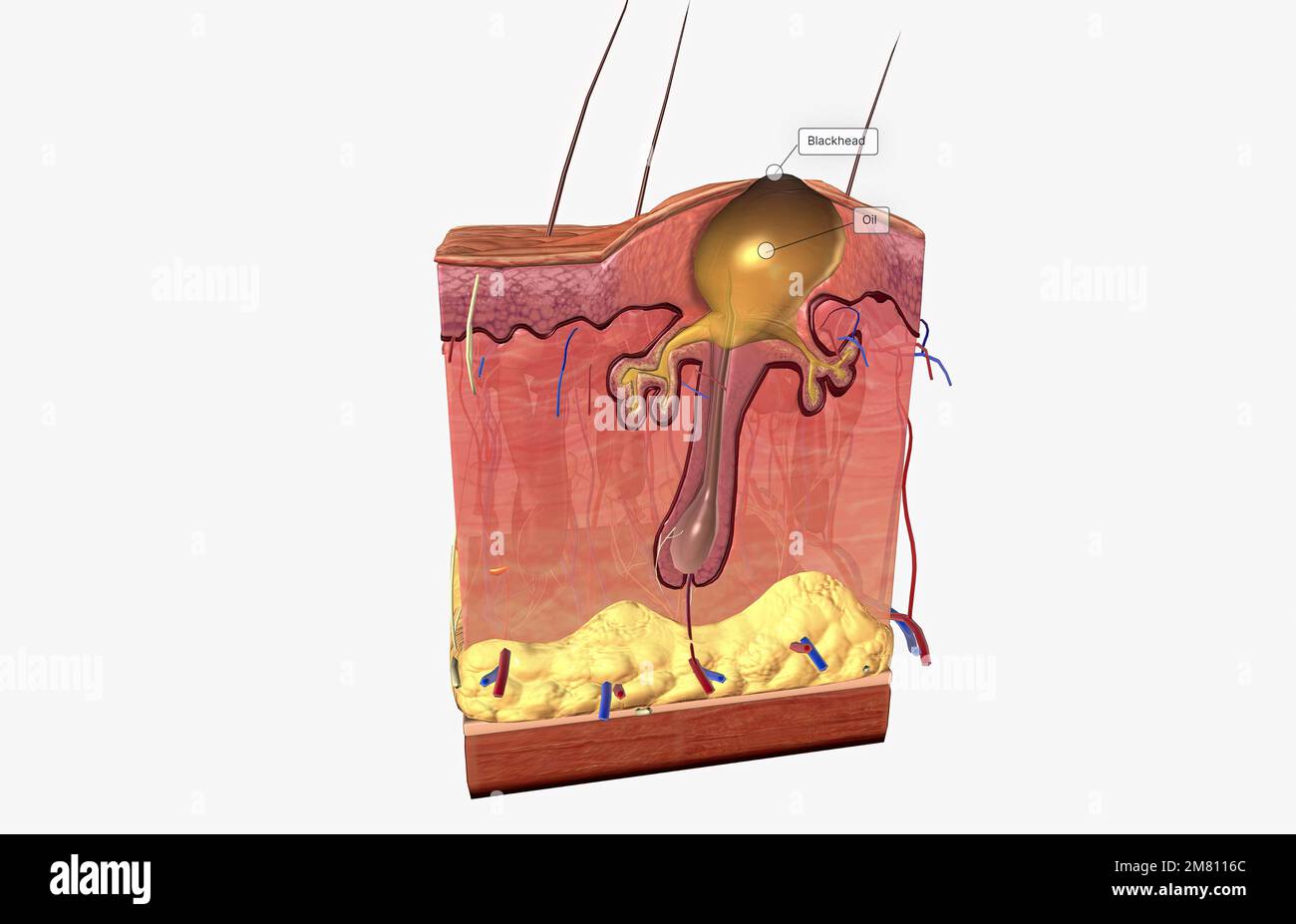 Human hair follicles anatomy hi-res stock photography and images - Alamy