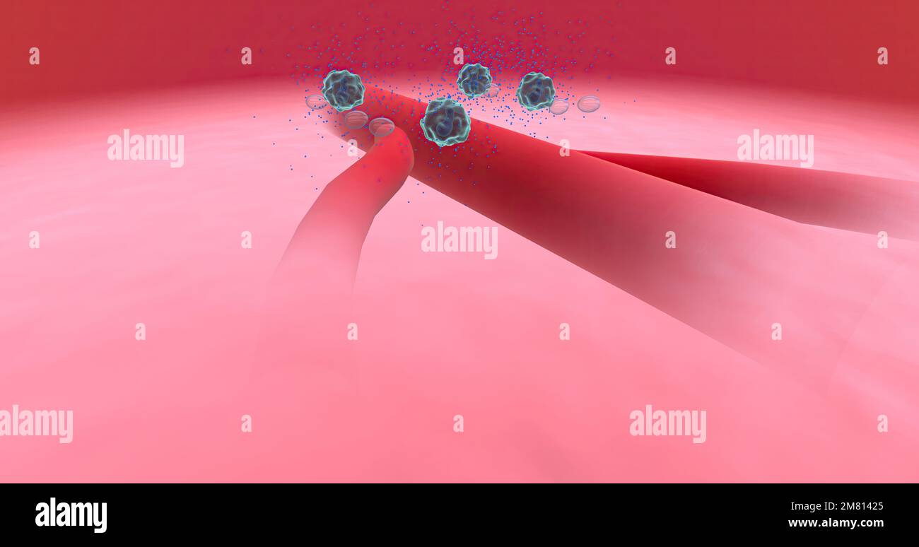 Tonsil membrane hi-res stock photography and images - Alamy