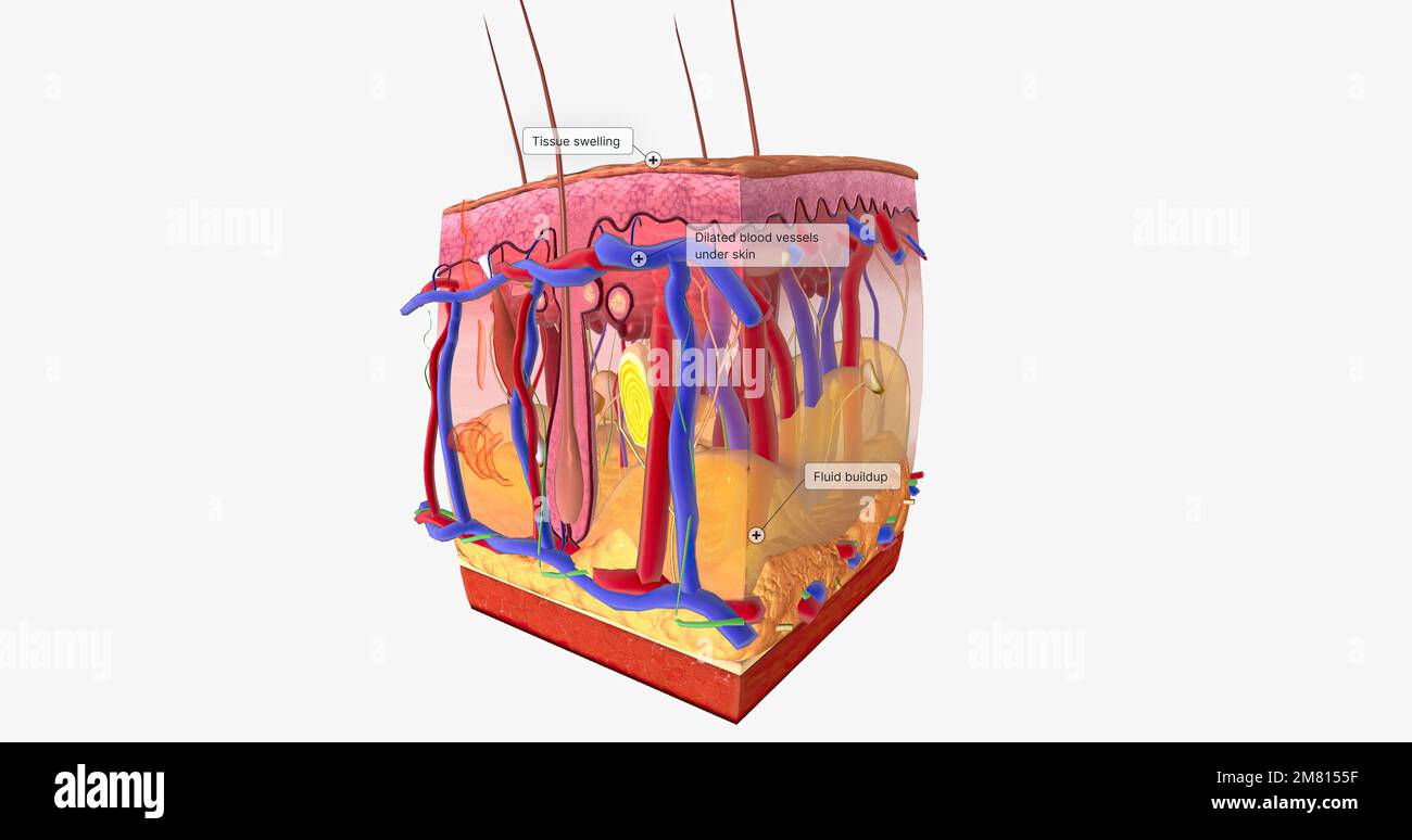 Cutaneous sense hi-res stock photography and images - Alamy