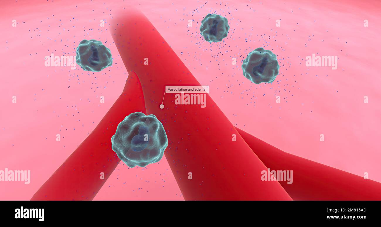 Tonsil membrane hi-res stock photography and images - Alamy