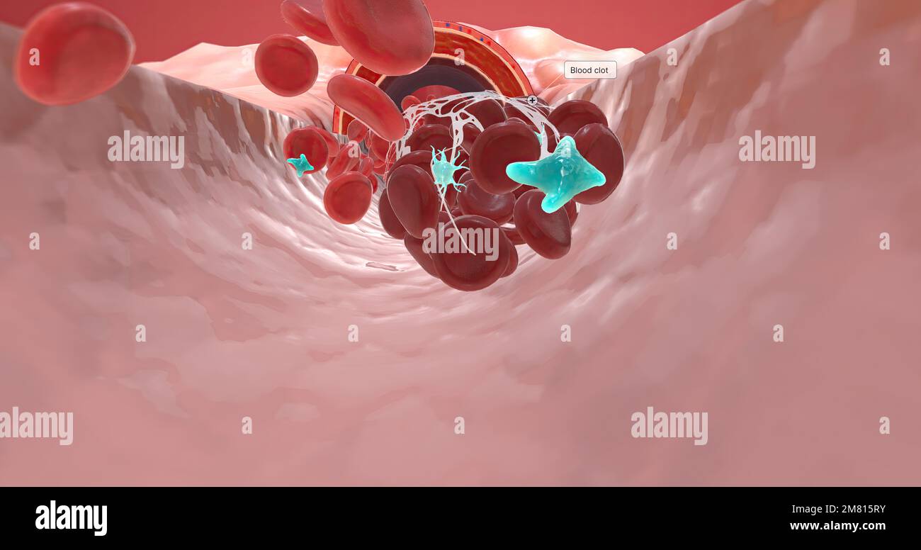 Fibrin red white cells hi-res stock photography and images - Alamy