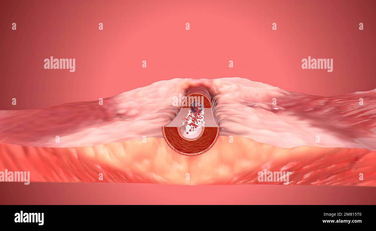 Mhc molecules hi-res stock photography and images - Alamy