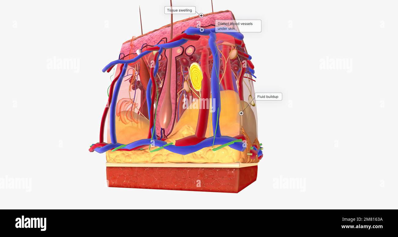 Keratinised epithelium hi-res stock photography and images - Alamy