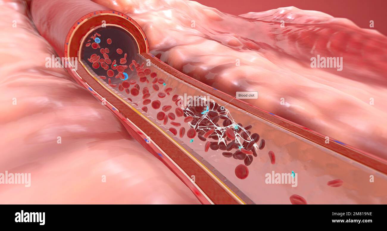 Fibrin red white cells hi-res stock photography and images - Alamy