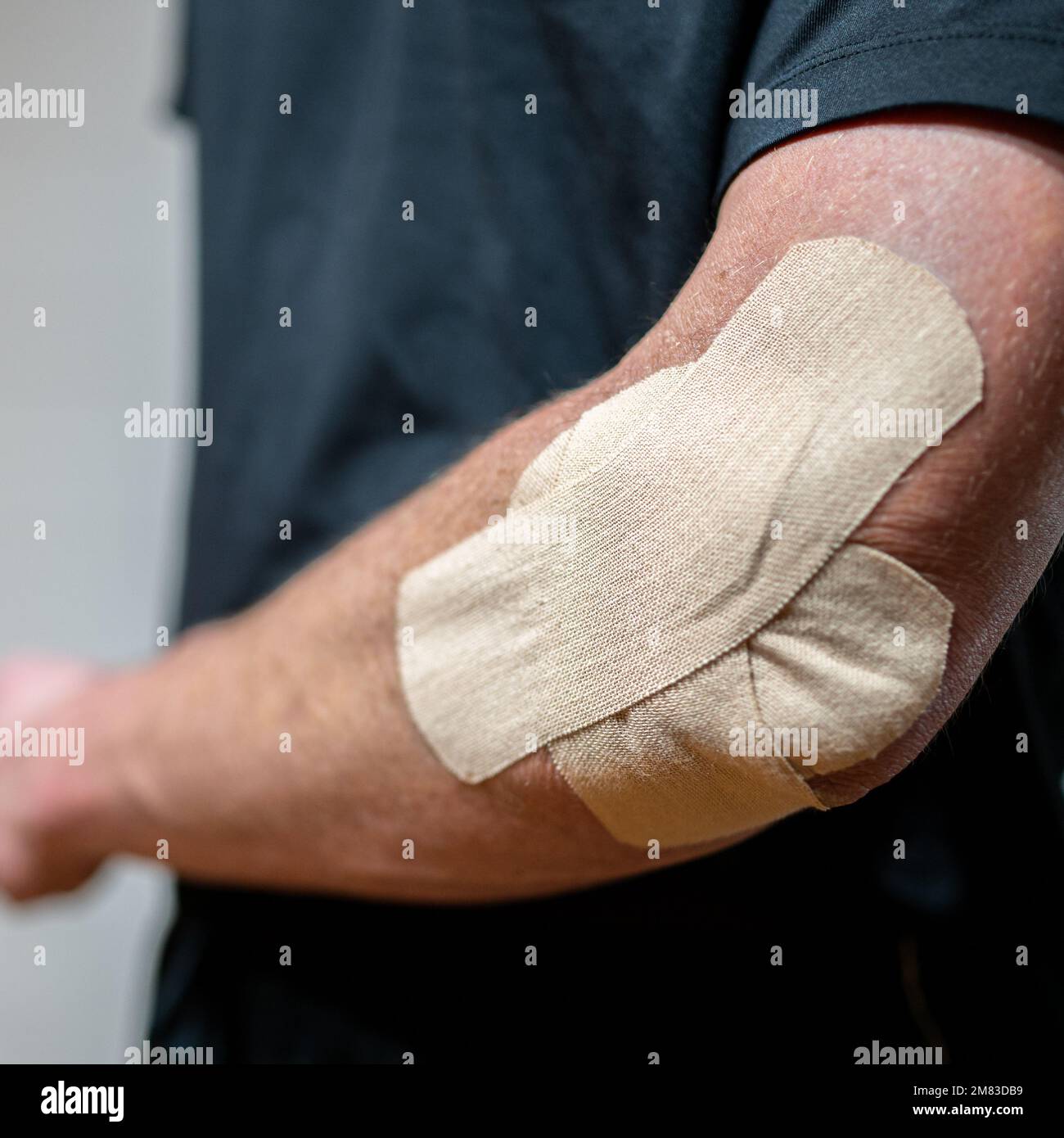 "Tennis elbow" taped with elastic therapeutic at orthopedic ward close ...