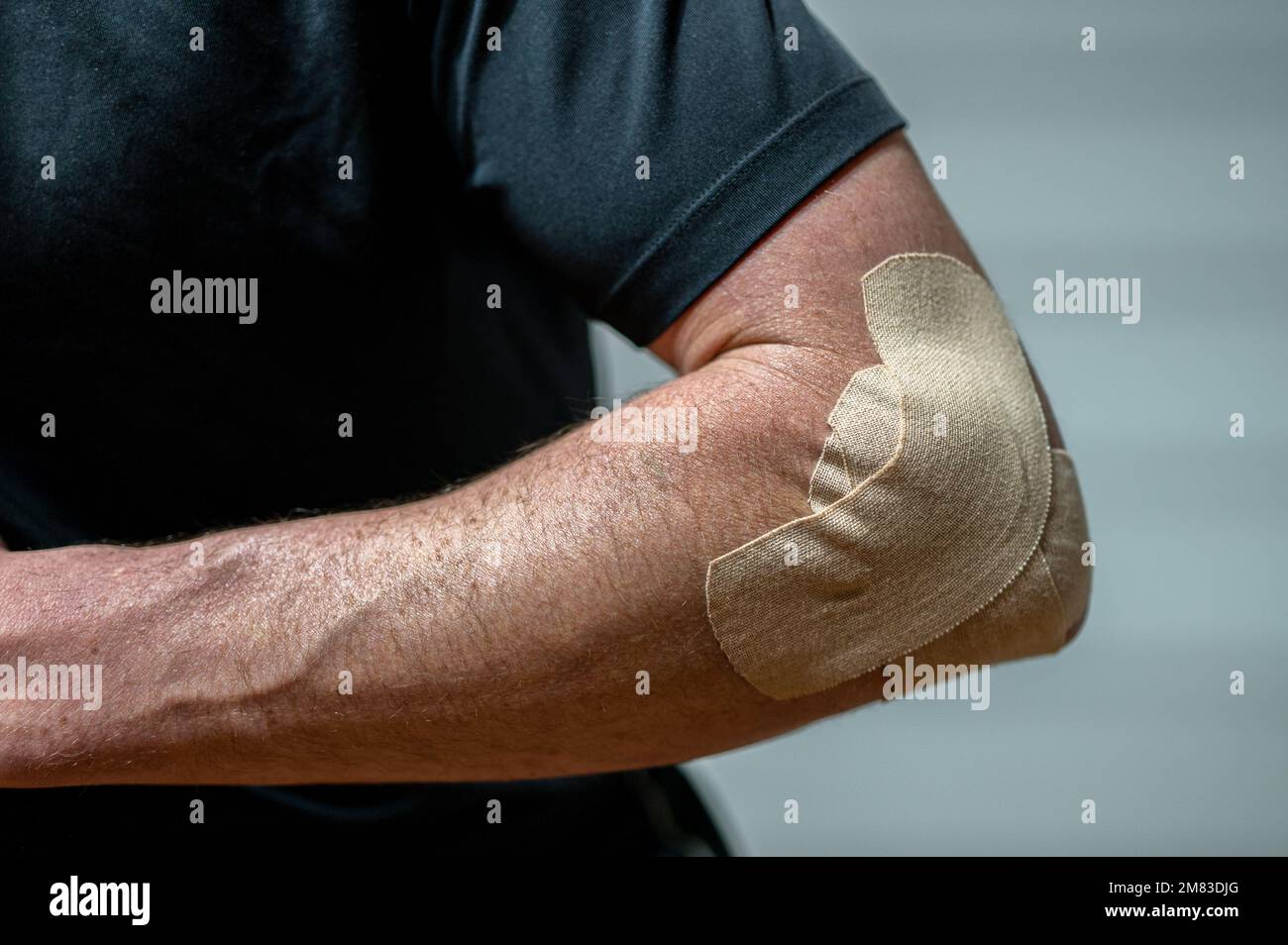 "Tennis elbow" taped with elastic therapeutic at orthopedic ward close ...