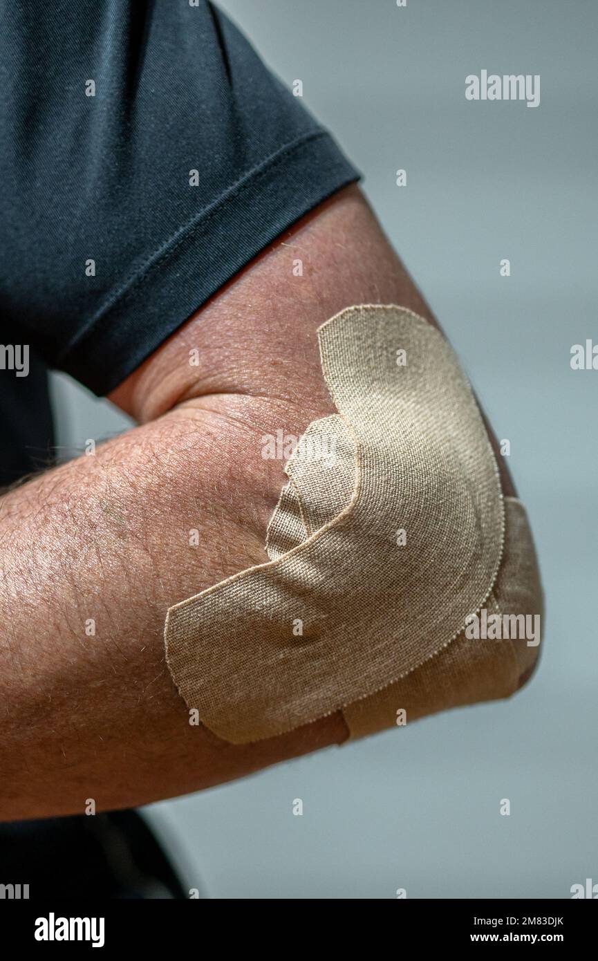 "Tennis elbow" taped with elastic therapeutic at orthopedic ward close ...