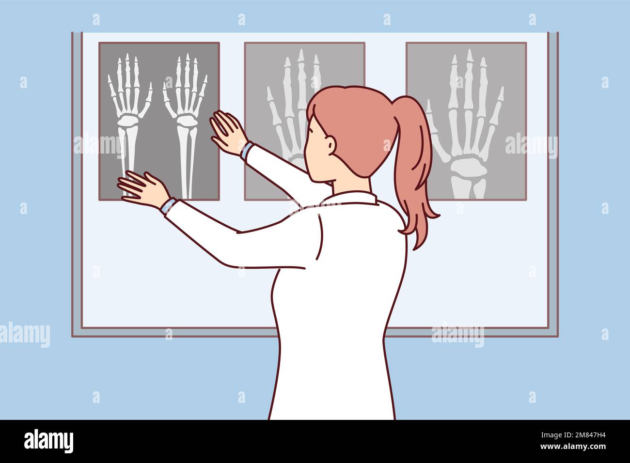 Woman surgeon applies X-ray of hand to luminous board to see sites of ...