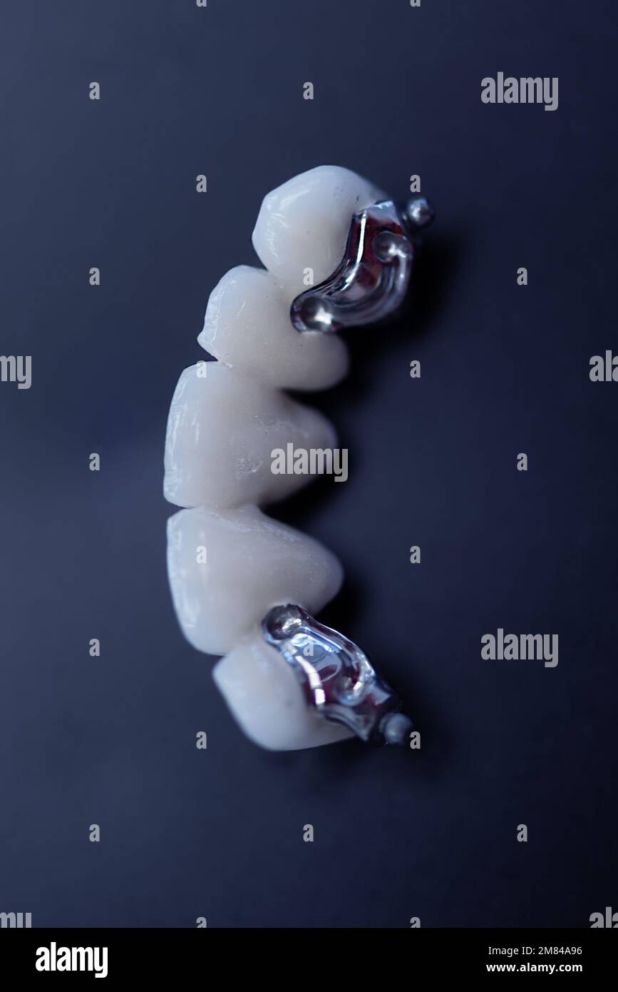 Close up tooth model / mock tooth in dental clinic Dental care and ...