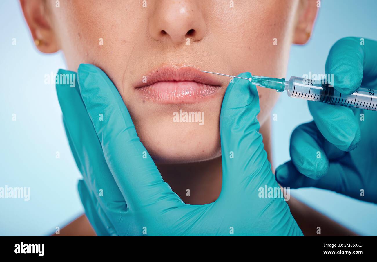 Botox, hands and mouth surgery with a woman and doctor in studio on a ...