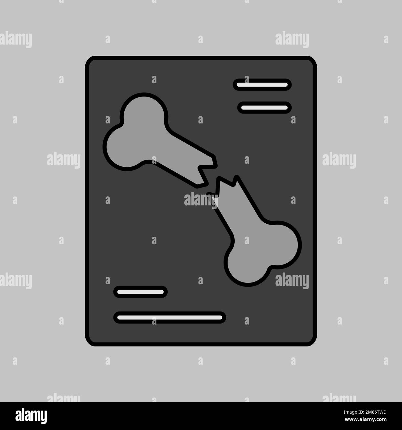 Bone fracture X-ray scan vector grayscale icon. Medicine and healthcare ...