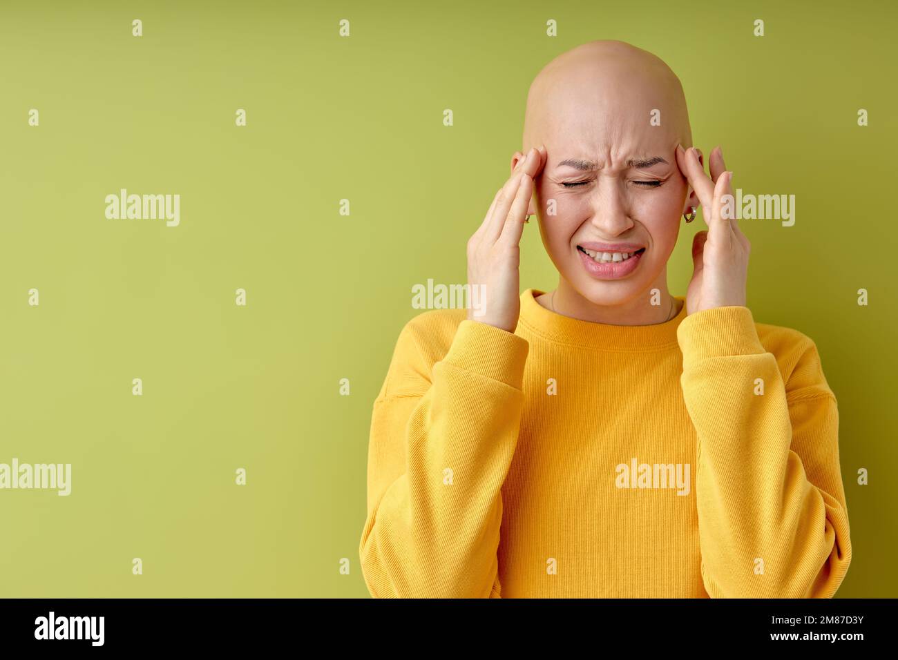 Hairless annoyed american woman touching head with fingers, suffering ...