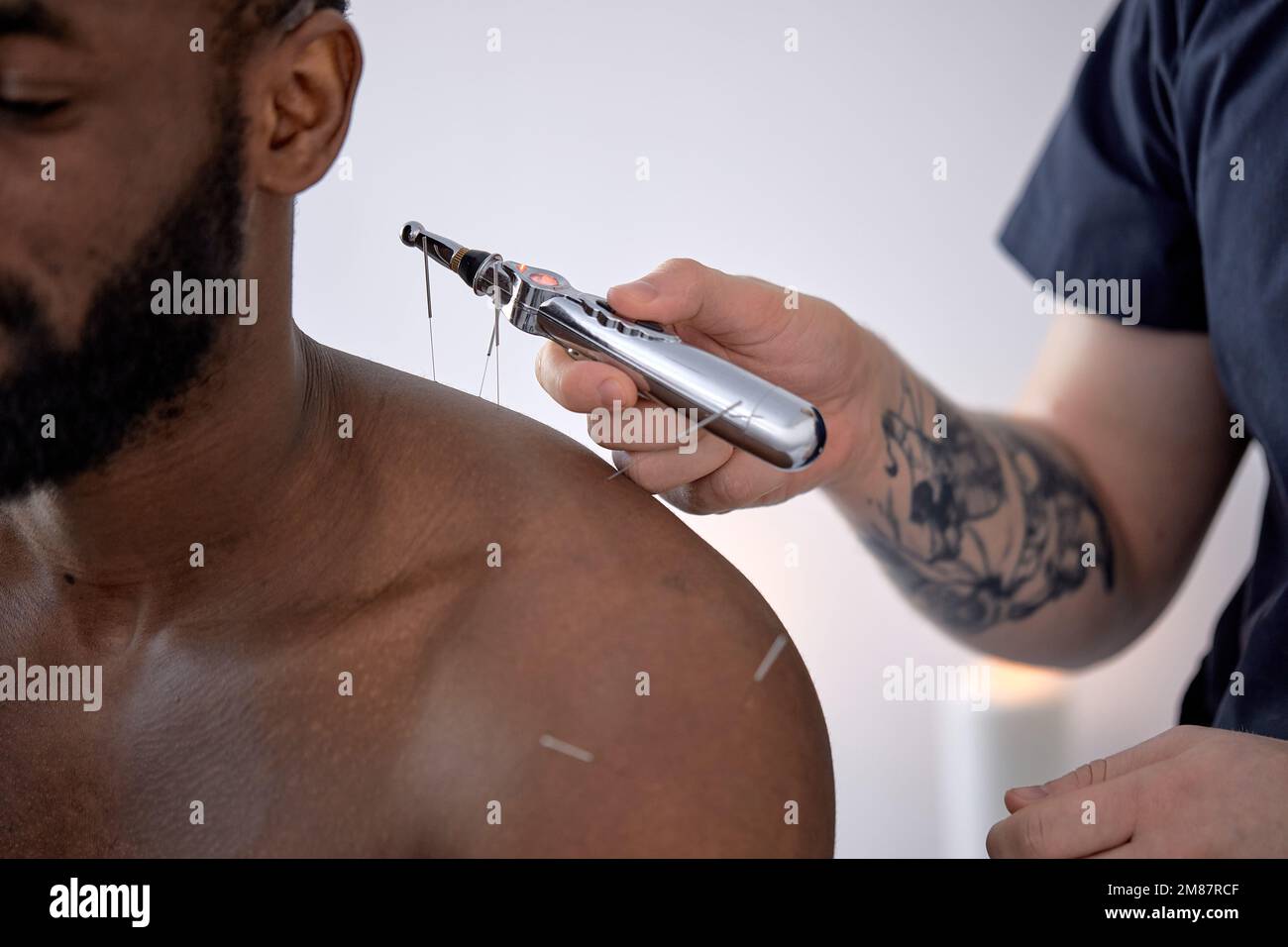 cropped doctor sticks needles into black male body on the acupuncture ...