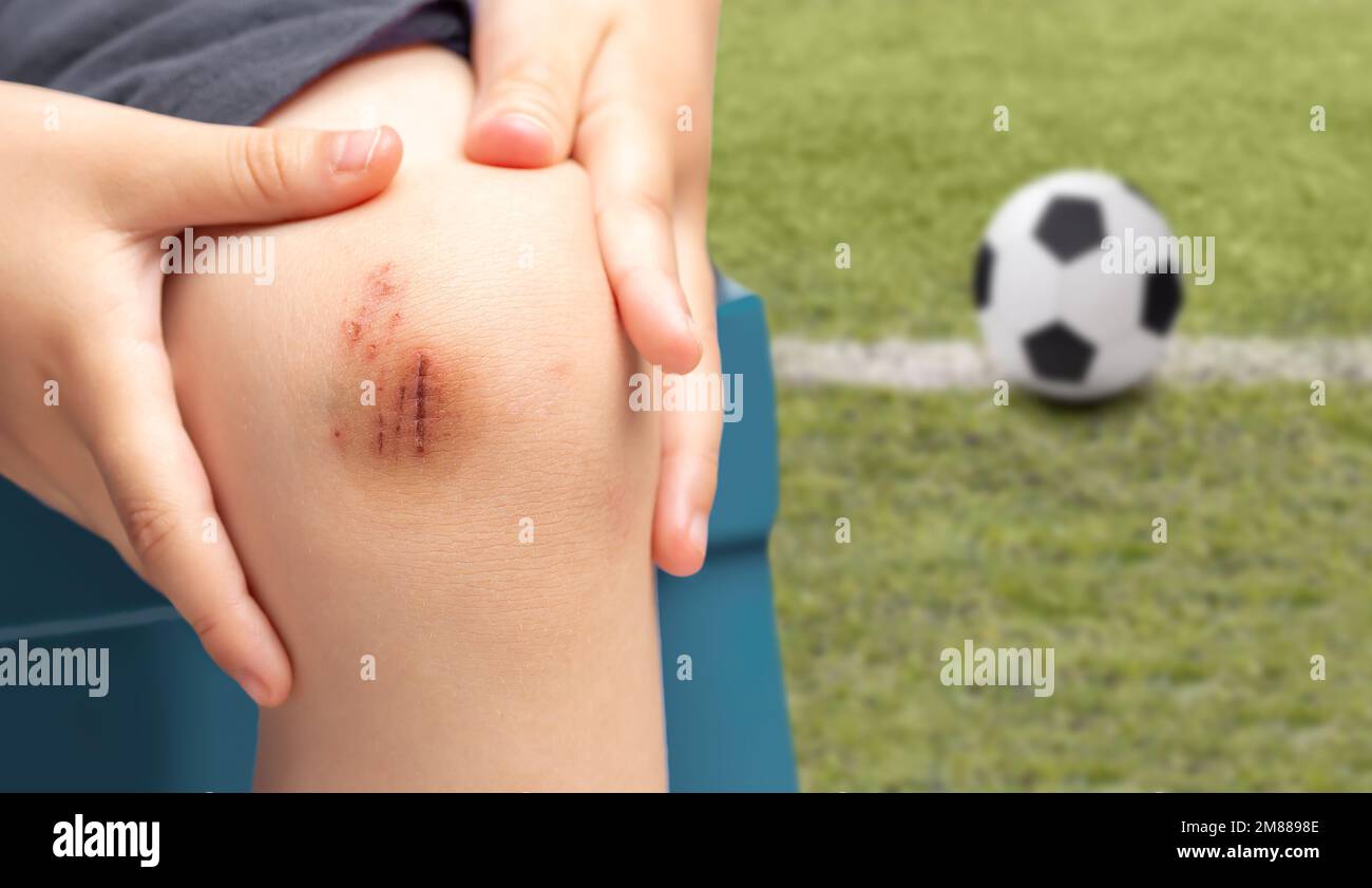 Close-up of a child male soccer player suffering from knee injury on ...