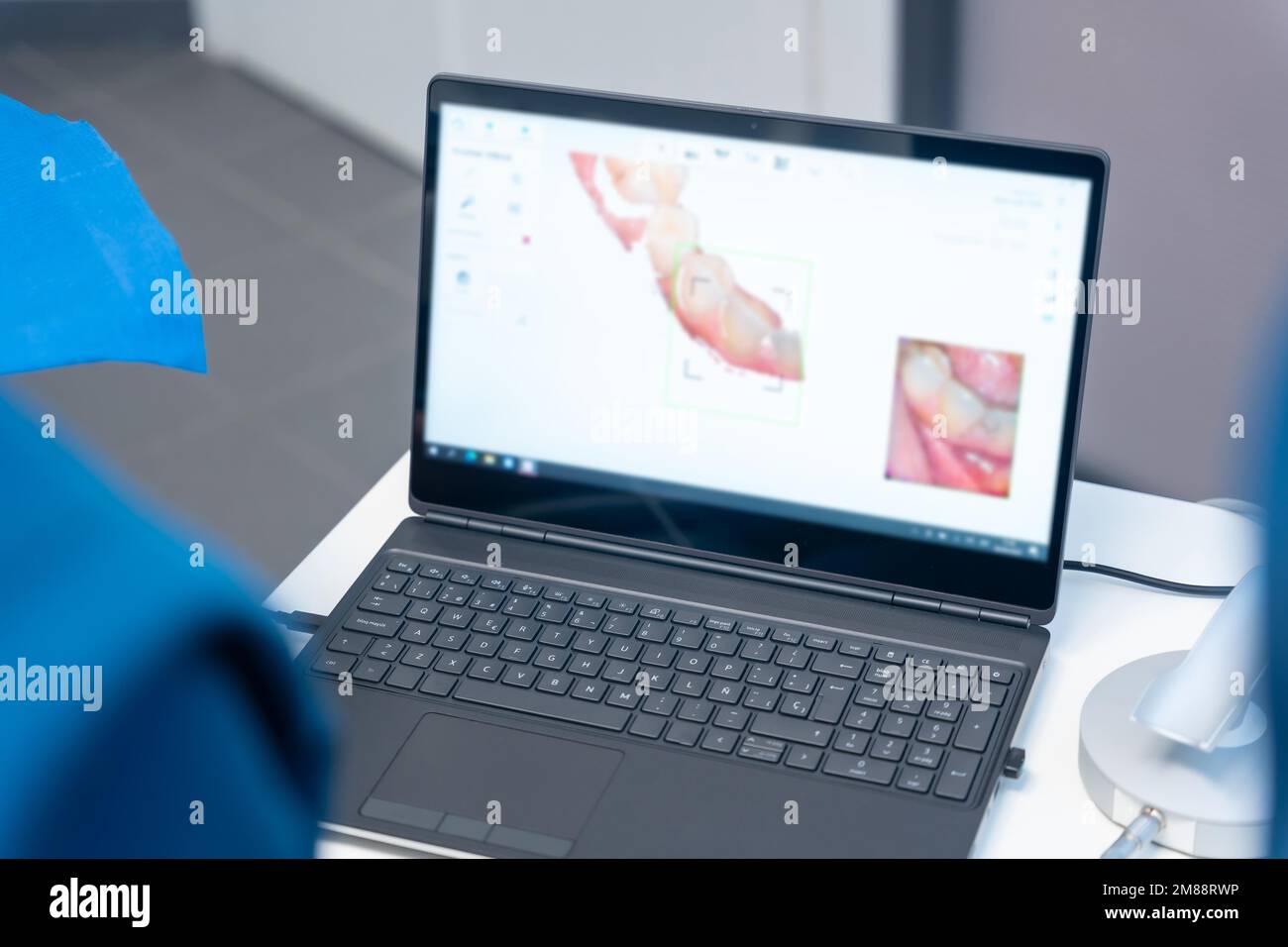 Dental clinic, dentist performing a 3d scan to the patient with the ...