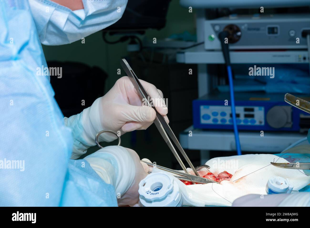 Hands of a surgeon in surgical gloves operating on a patient with ...