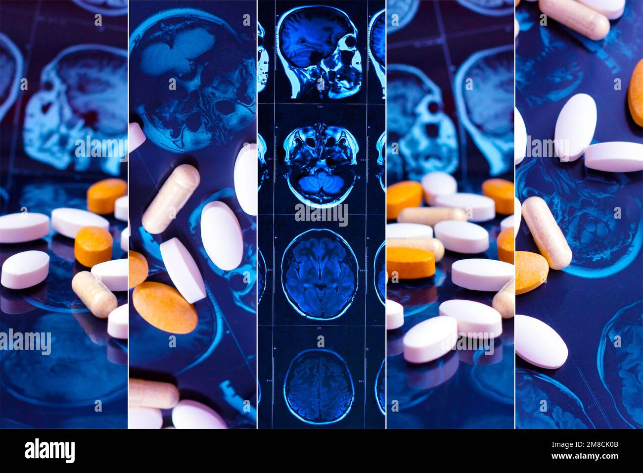 Different pharmaceutical medicine pills on magnetic brain resonance ...