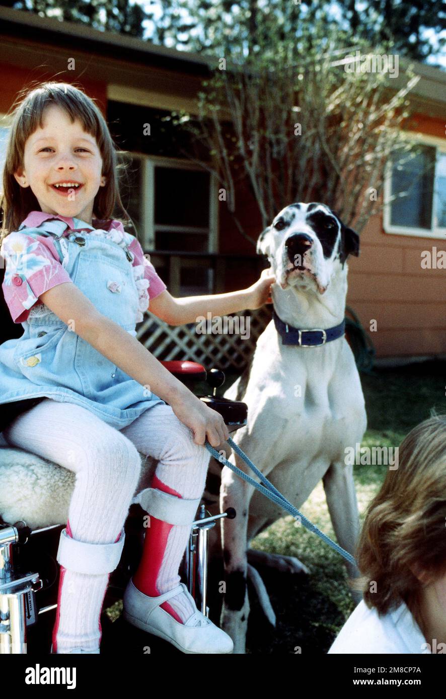 Four-year-old Erin Burney, Washington's 1990 Muscular Dystrophy ...