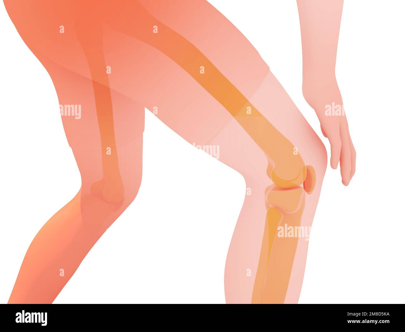 3D illustration of the anatomy of the knee with pain. Transparent image ...