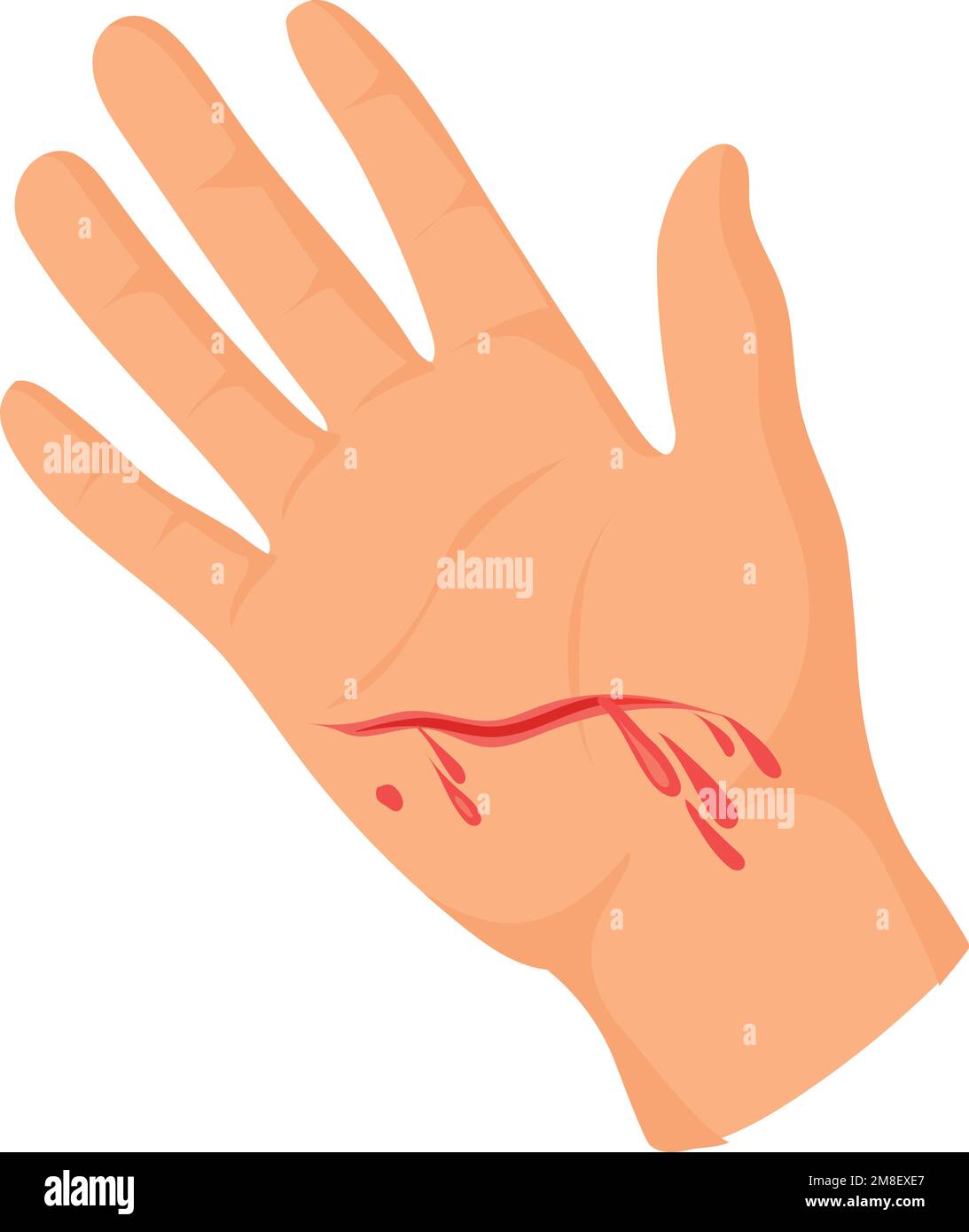 Hand with bleeding cut. Palm wound. Injury icon isolated on white ...