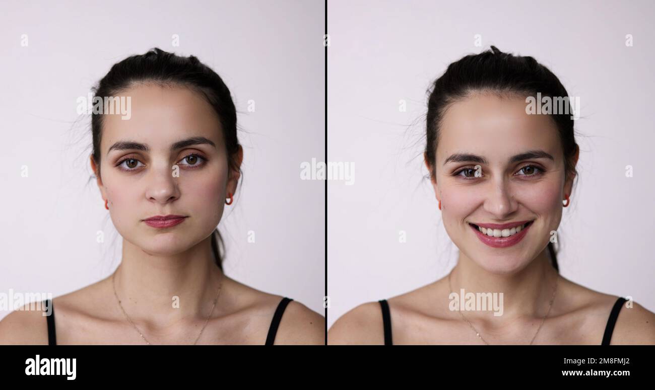 Before After Young Woman Aesthetic Facelift. Rhinoplasty Nose And Mid ...