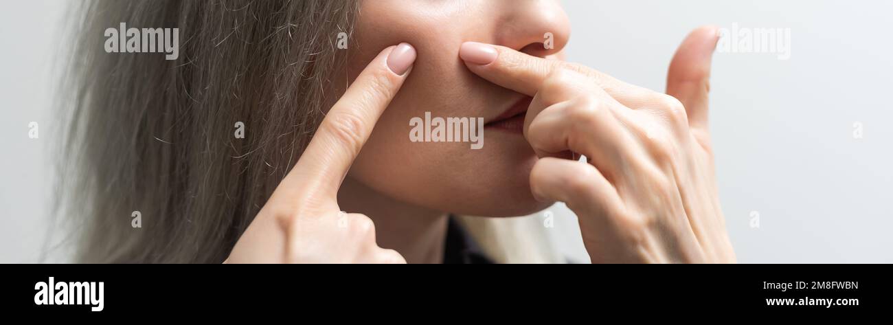 young woman squeezing pimples on the face Stock Photo - Alamy