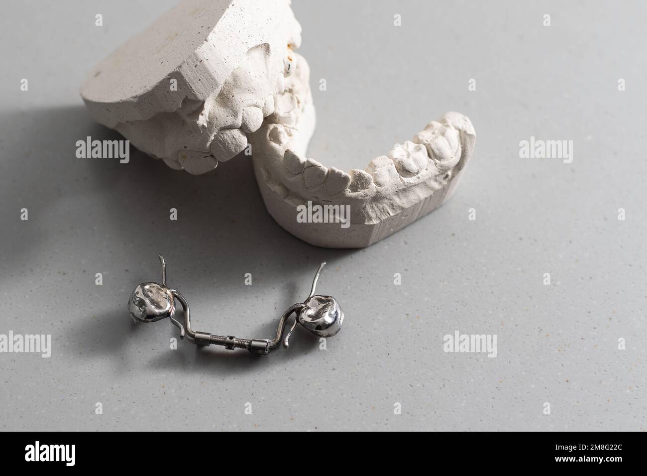 Plaster models of dental prostheses. Demonstration models of dentures ...
