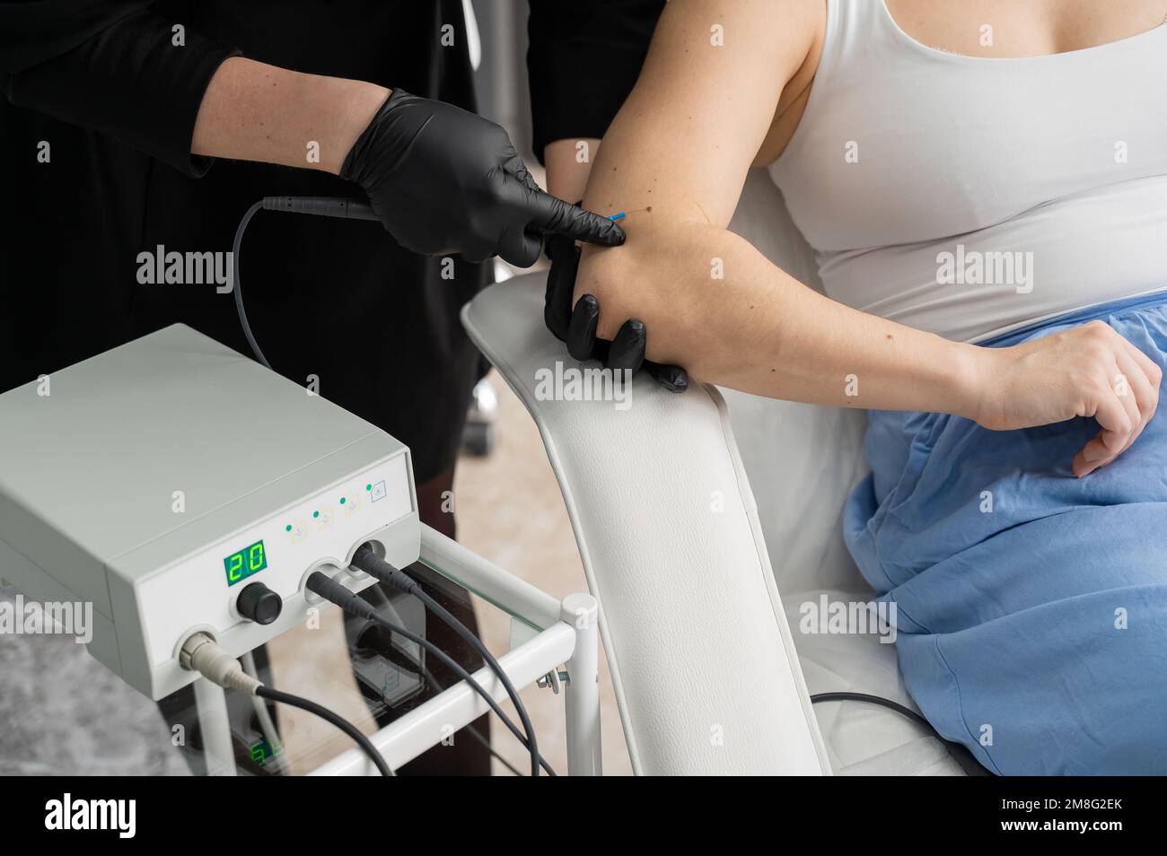 Dermatologist removes a mole on a patient's arm using an ...