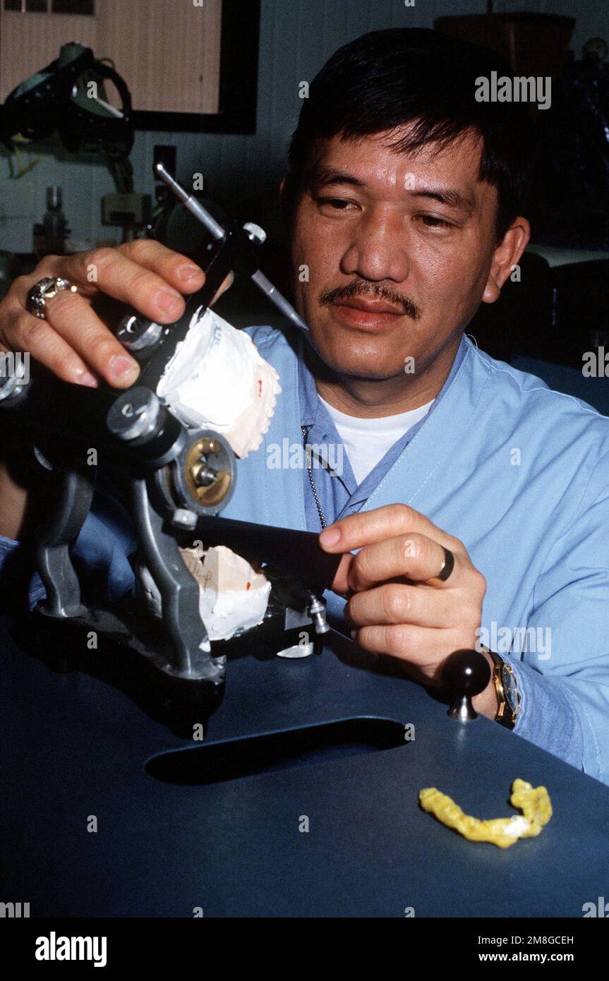 A dental technician measures molds for a new set of dentures in the ...