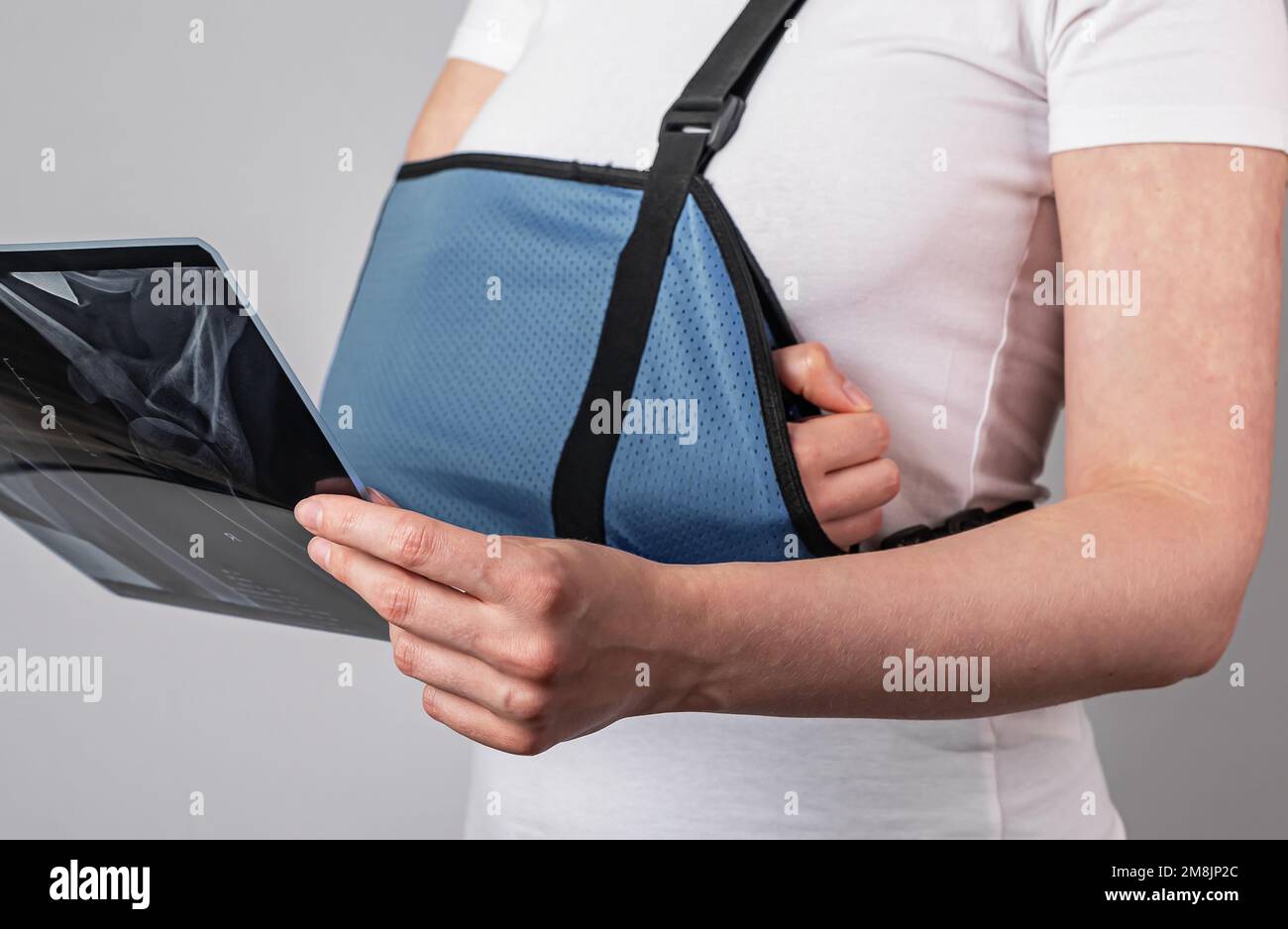 Arm sling and injury scan. Broken hand in orthopedic bandage for limb ...