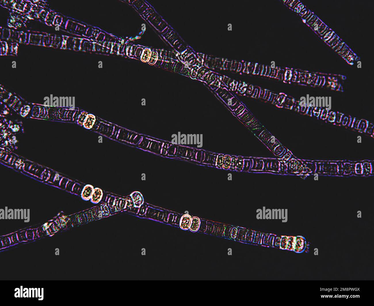 Nodularia sp. toxic algae under microscopic view x40, dark background ...