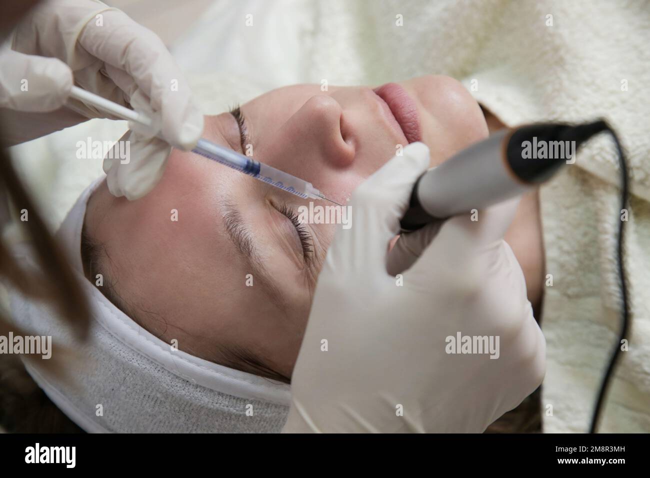 Mesotherapy. Woman having dermapen facial treatment. Micro needle ...