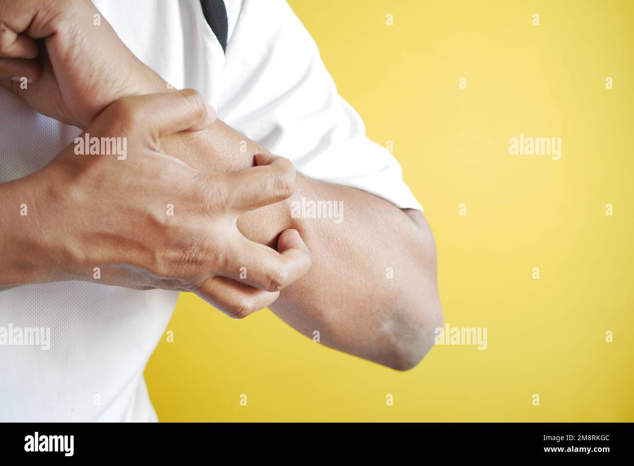 Itch rash hi-res stock photography and images - Alamy