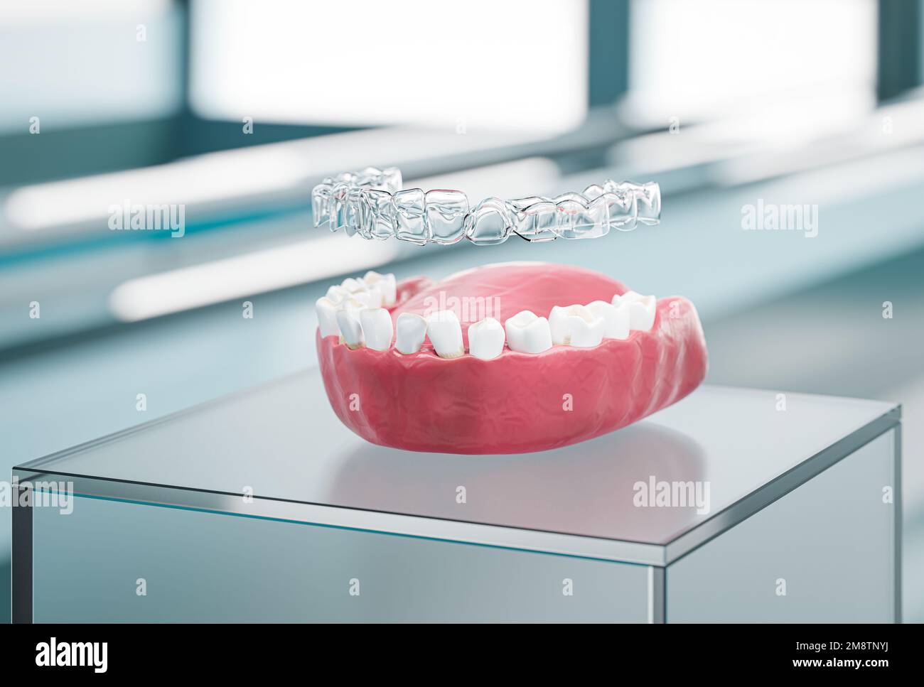 Transparent aligner orthodontic device above teeth cast. 3d ...