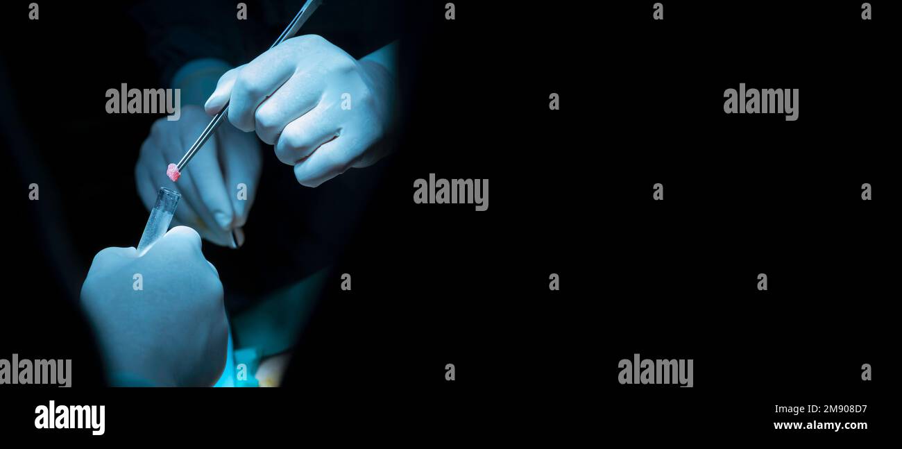 concentrated professional surgical doctor team operating surgery a ...