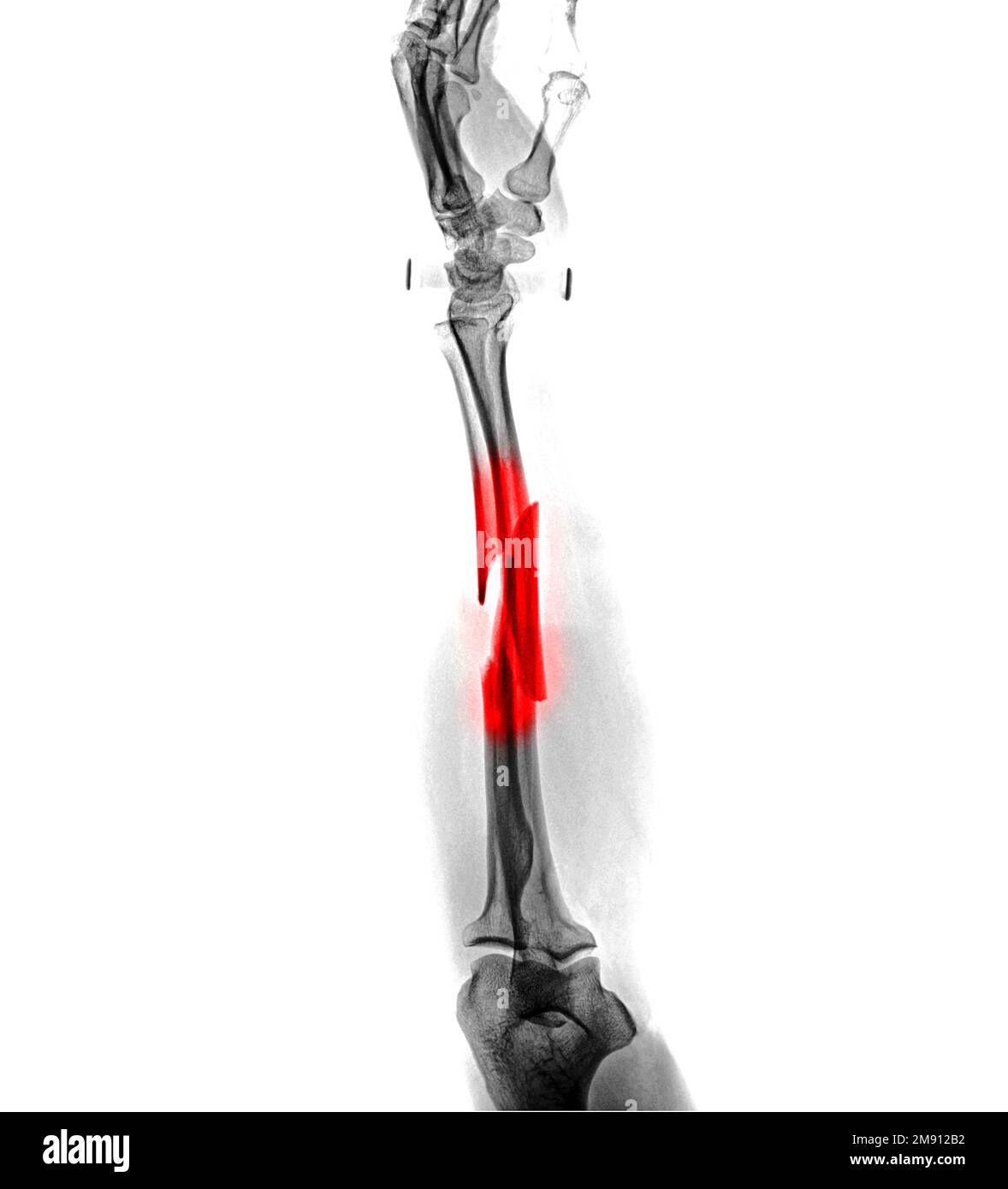 Film wrist joint hi-res stock photography and images - Alamy