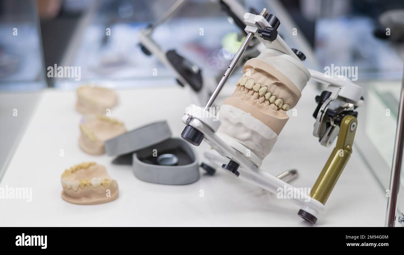 Plaster cast of the jaw in the articulator in the prosthetic workshop ...