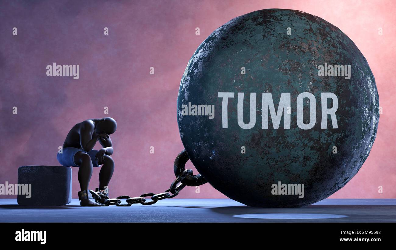 Tumor that limits life and make suffer hi-res stock photography and ...
