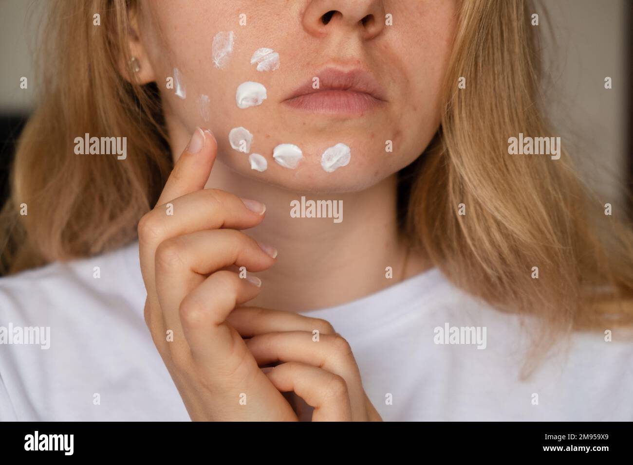 Unrecognizable woman applies makeup, cream serum cure for acne on face ...