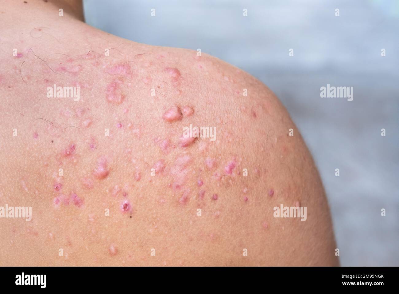 Weird Skin Infections