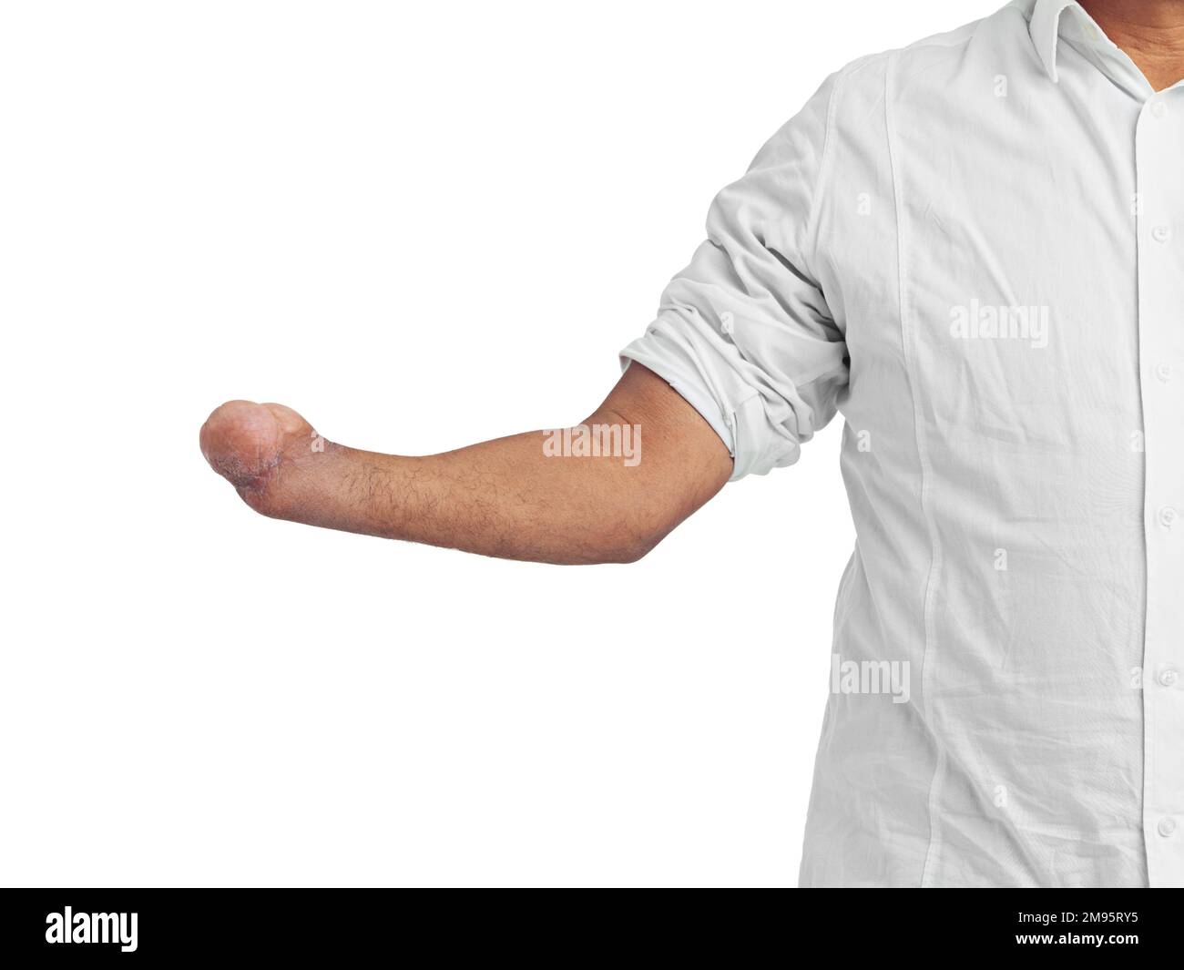 Model and disability hi-res stock photography and images - Alamy