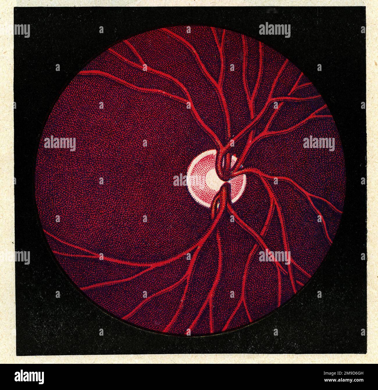 Normal fundus, illustration Stock Photo - Alamy