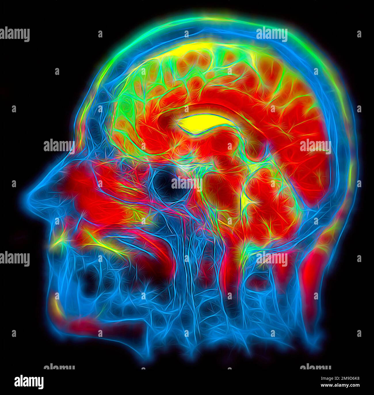 Healthy head and brain, MRI scan Stock Photo - Alamy