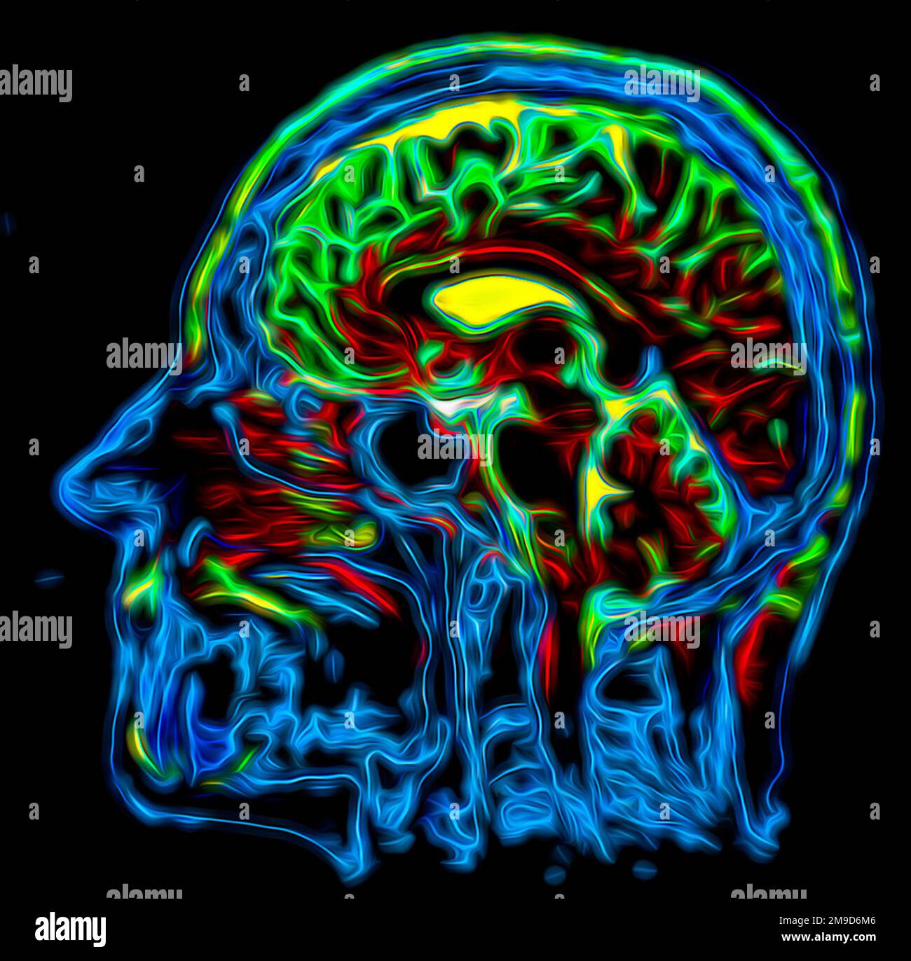 Healthy head and brain, MRI scan Stock Photo - Alamy