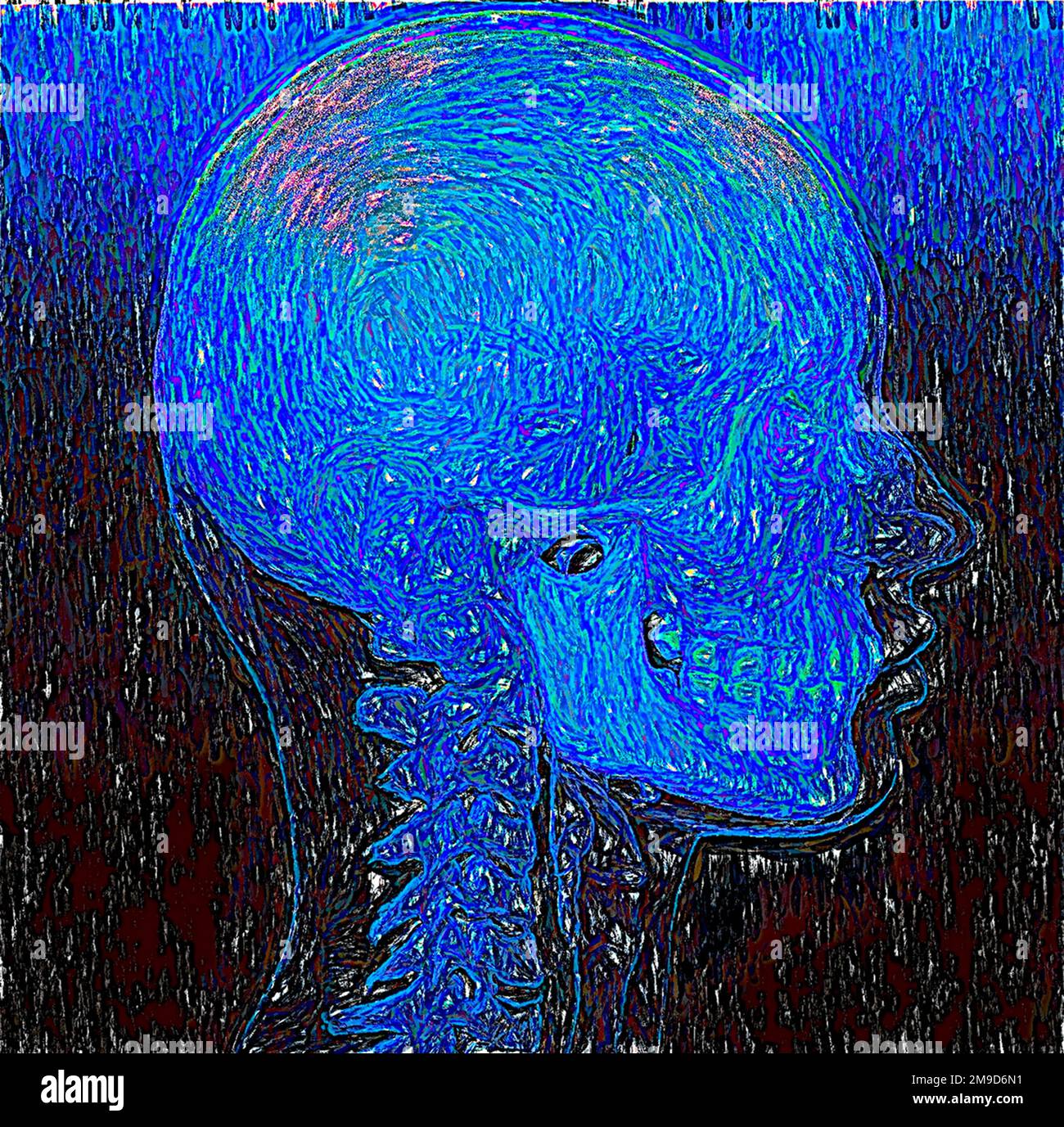 Head and neck bones, CT scan Stock Photo - Alamy