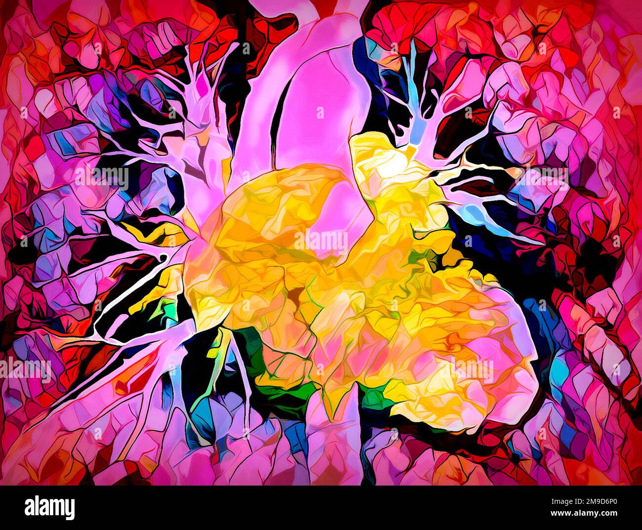 Healthy heart, CT scan Stock Photo - Alamy